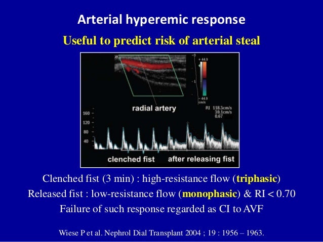 Doppler ultrasound of A-V access for hemodialysis