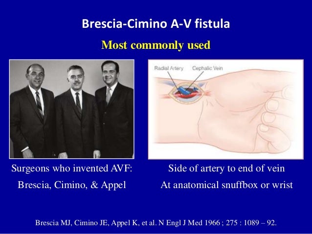 Doppler ultrasound of A-V access for hemodialysis