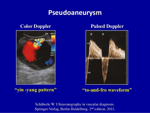 Doppler ultrasound of A-V access for hemodialysis
