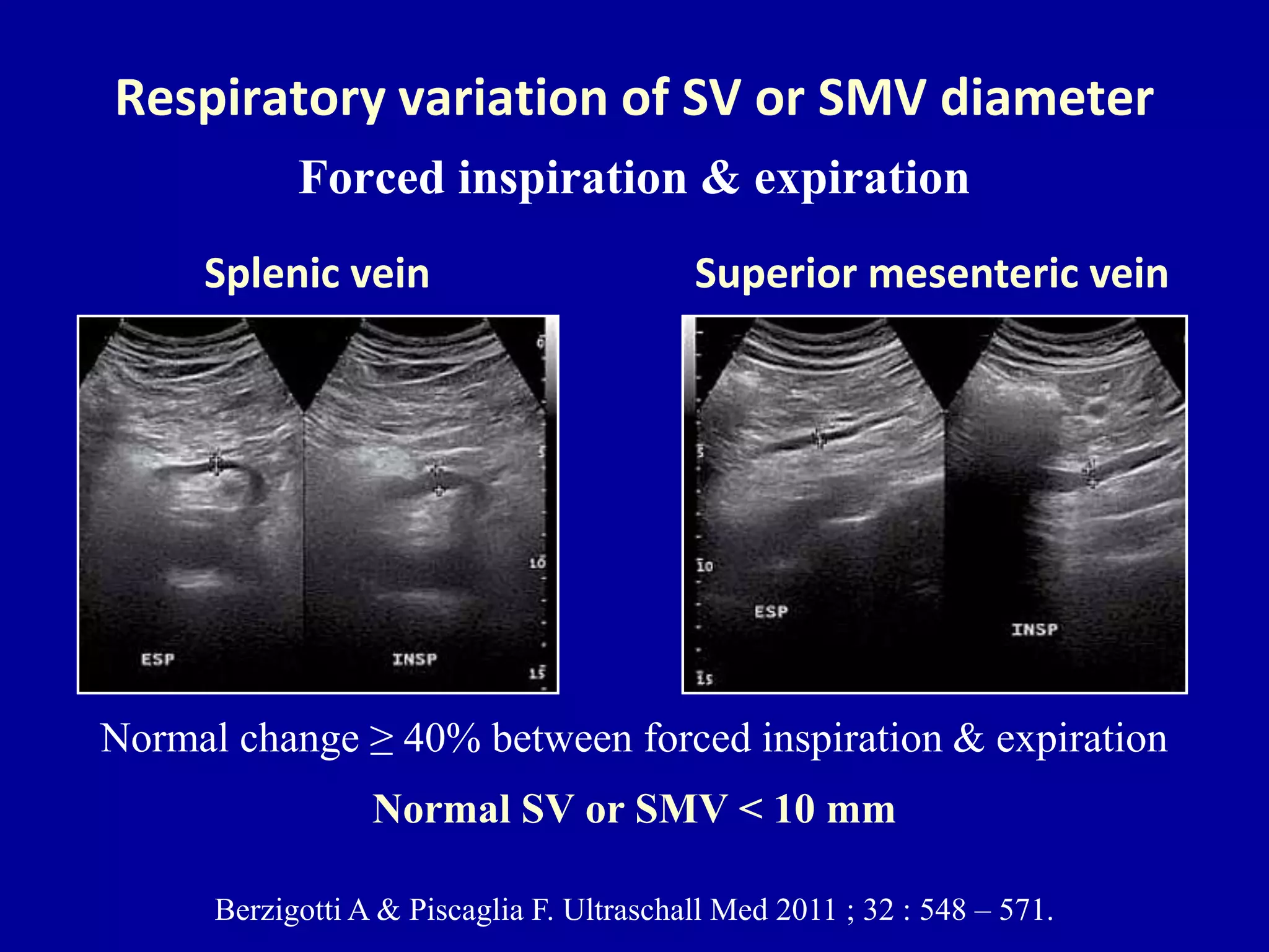 Doppler ultrasound of the portal system - Normal findings | PPTX
