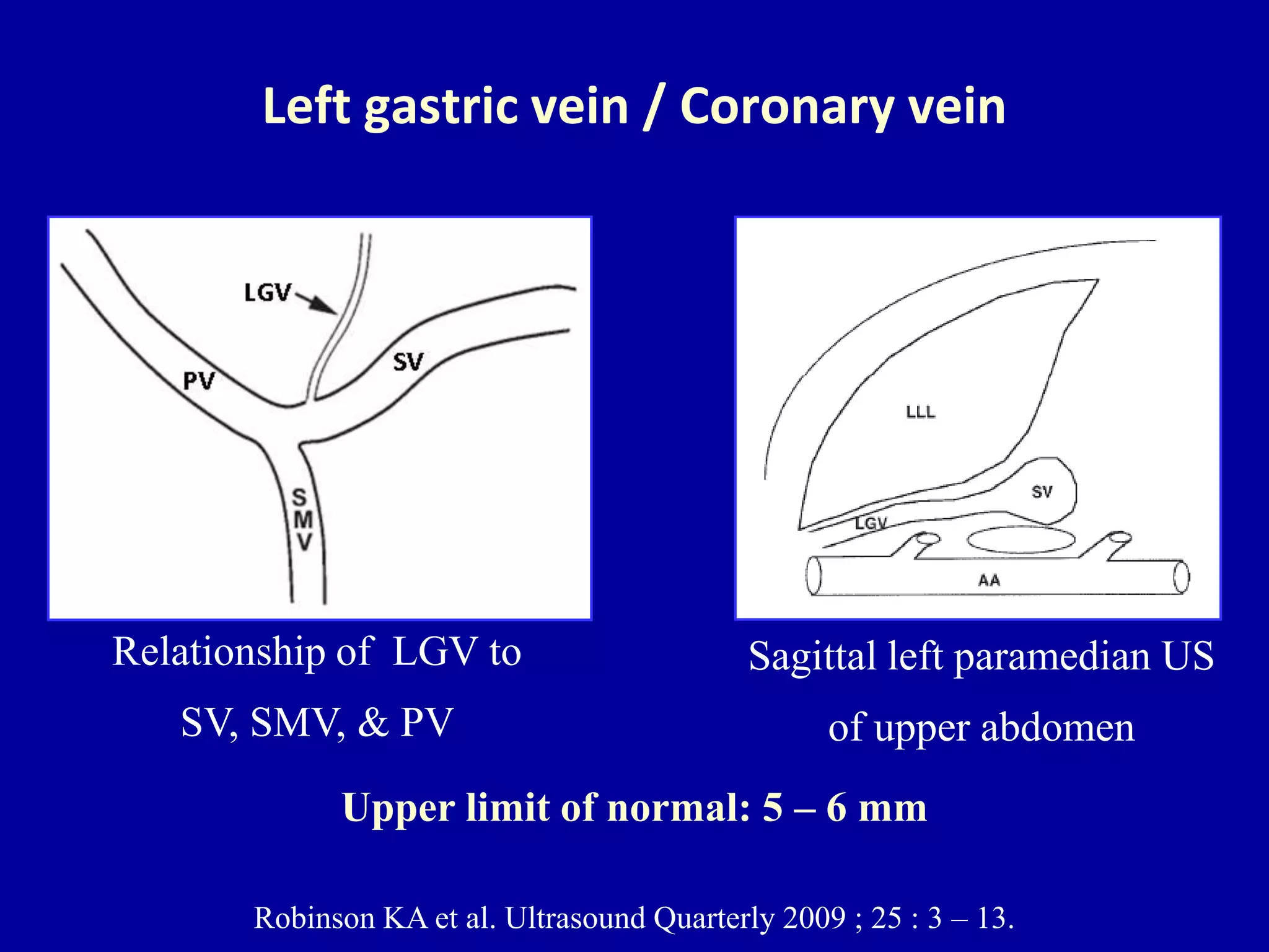 Doppler ultrasound of the portal system - Normal findings | PPTX