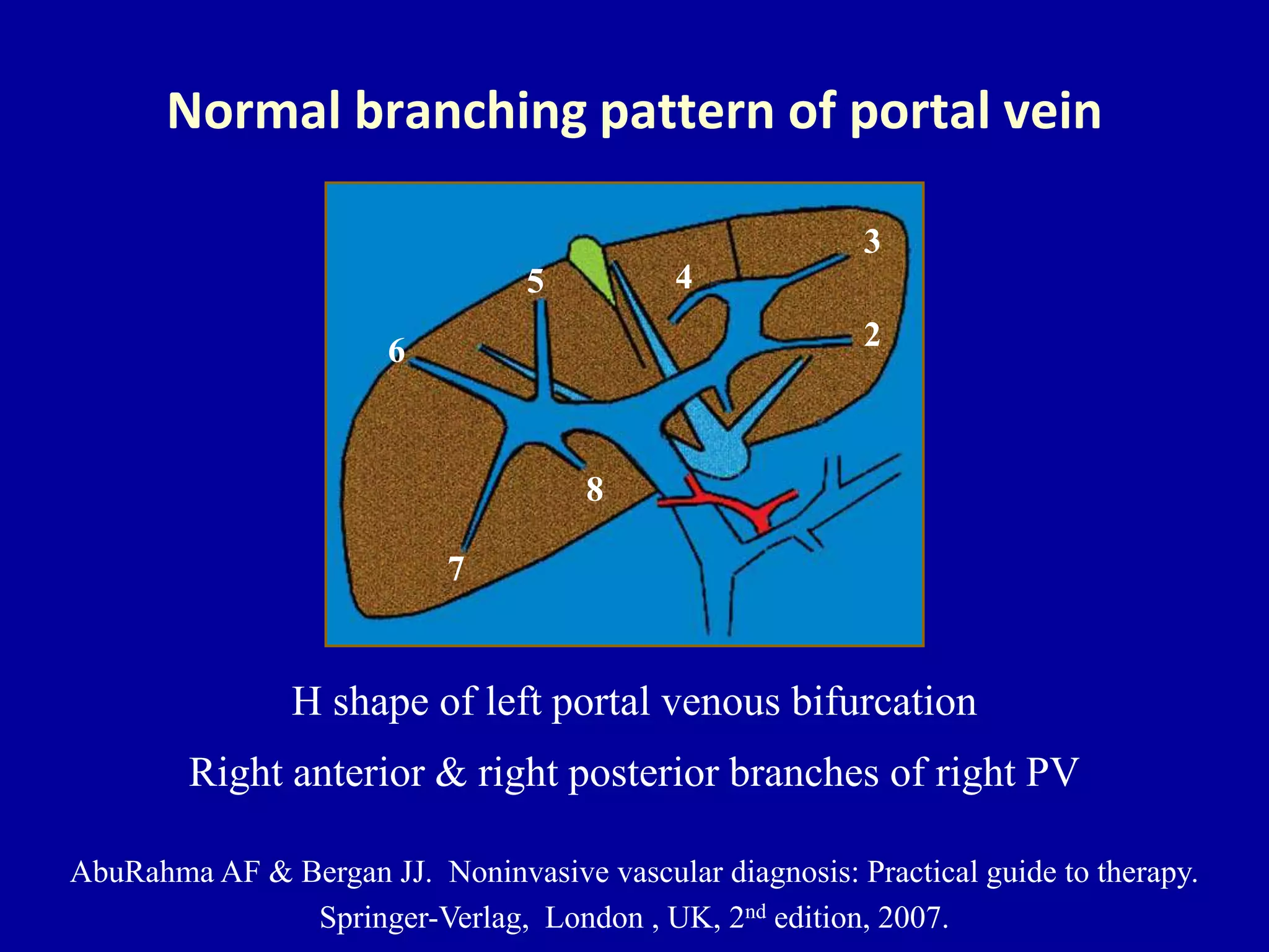 Doppler ultrasound of the portal system - Normal findings | PPTX