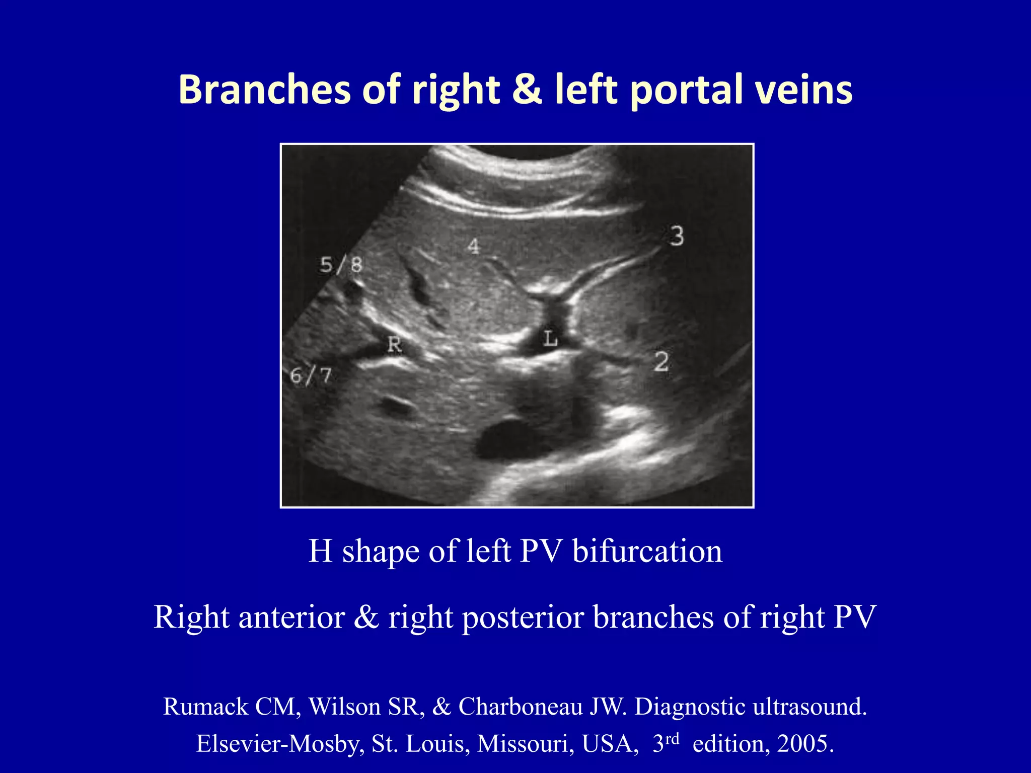 Doppler ultrasound of the portal system - Normal findings | PPTX