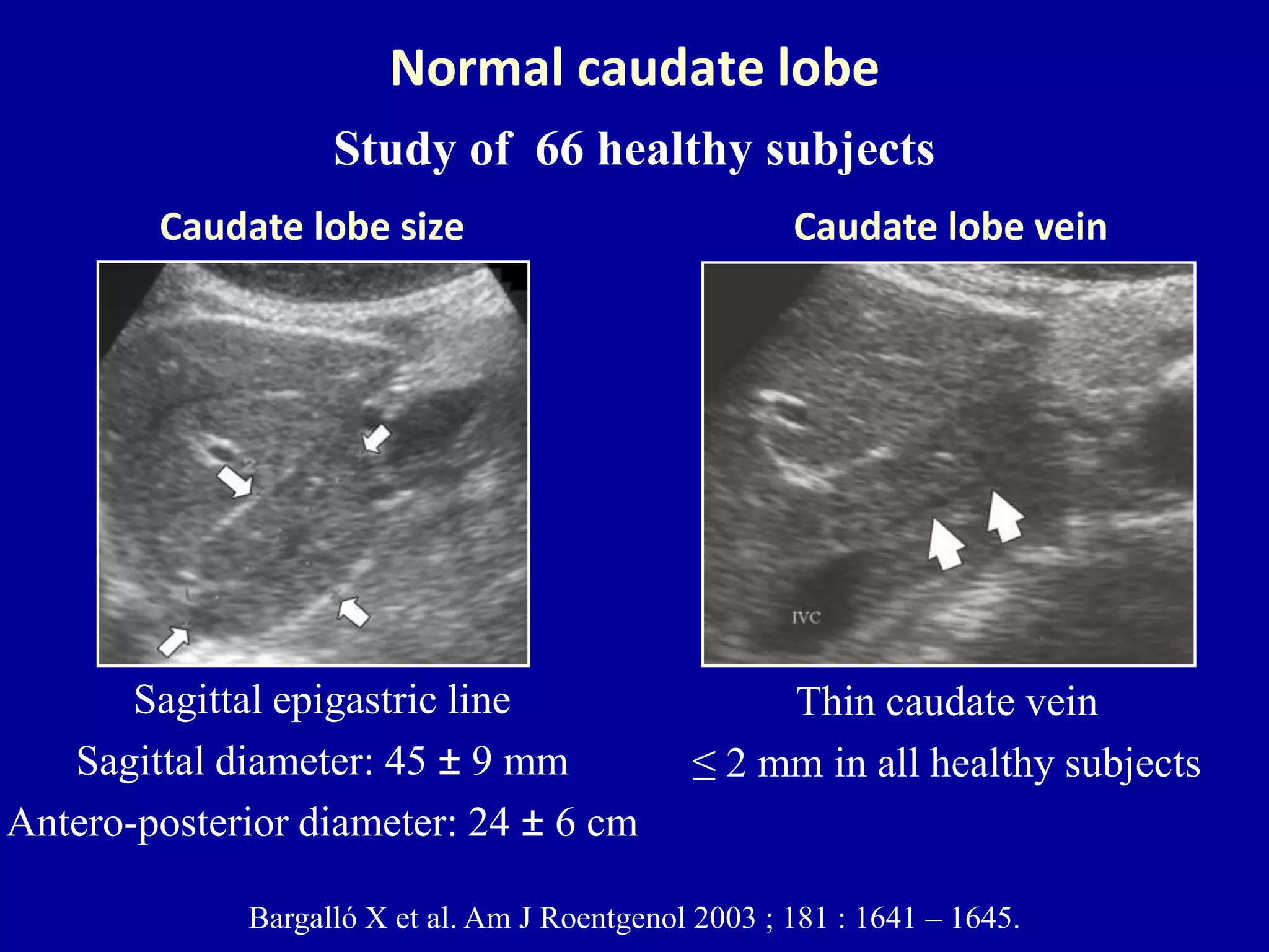 Doppler ultrasound of the portal system - Normal findings | PPTX