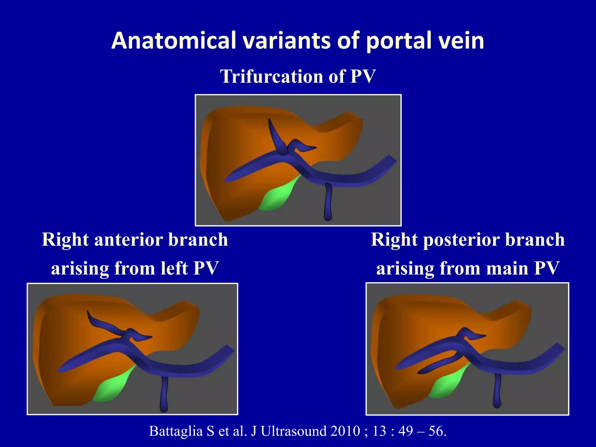 Doppler ultrasound of the portal system - Normal findings | PPTX