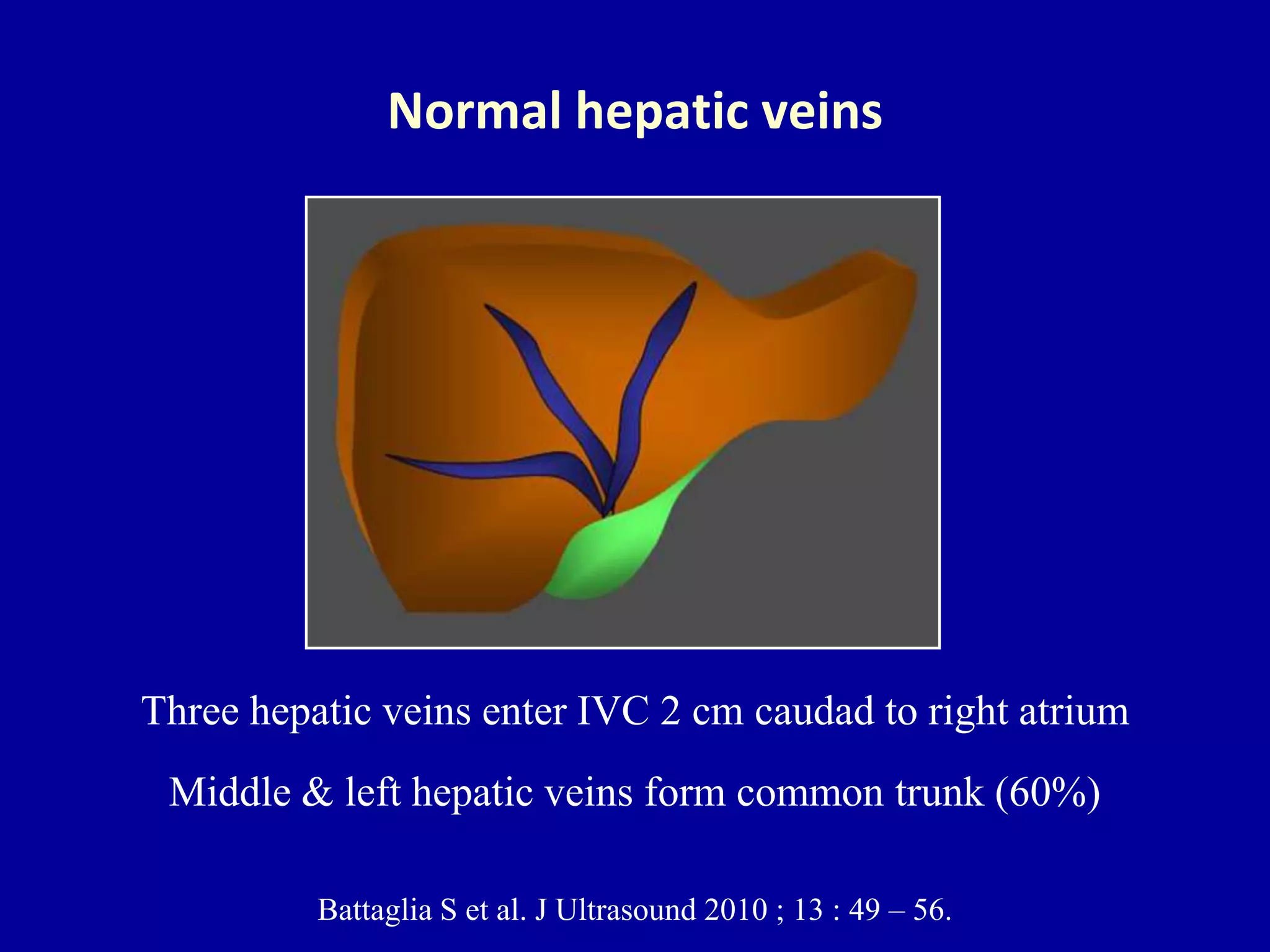Doppler ultrasound of the portal system - Normal findings | PPTX