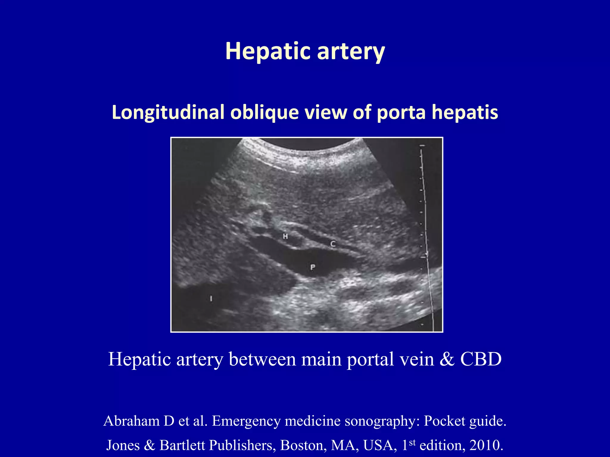Doppler ultrasound of the portal system - Normal findings | PPTX