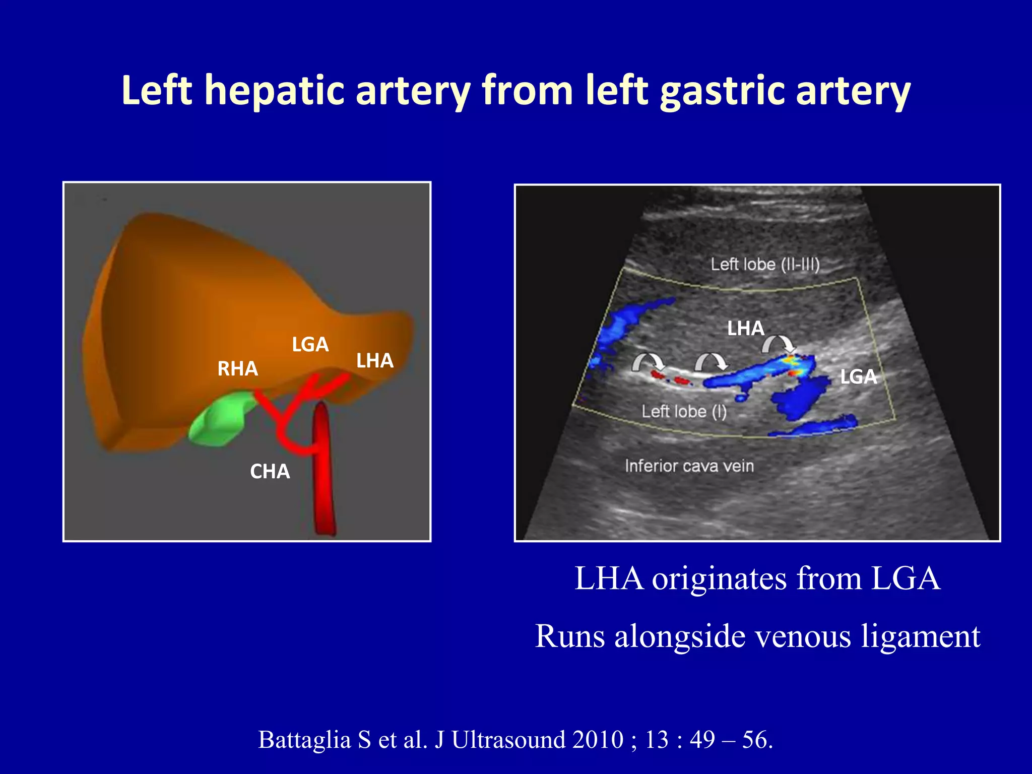 Doppler ultrasound of the portal system - Normal findings | PPTX