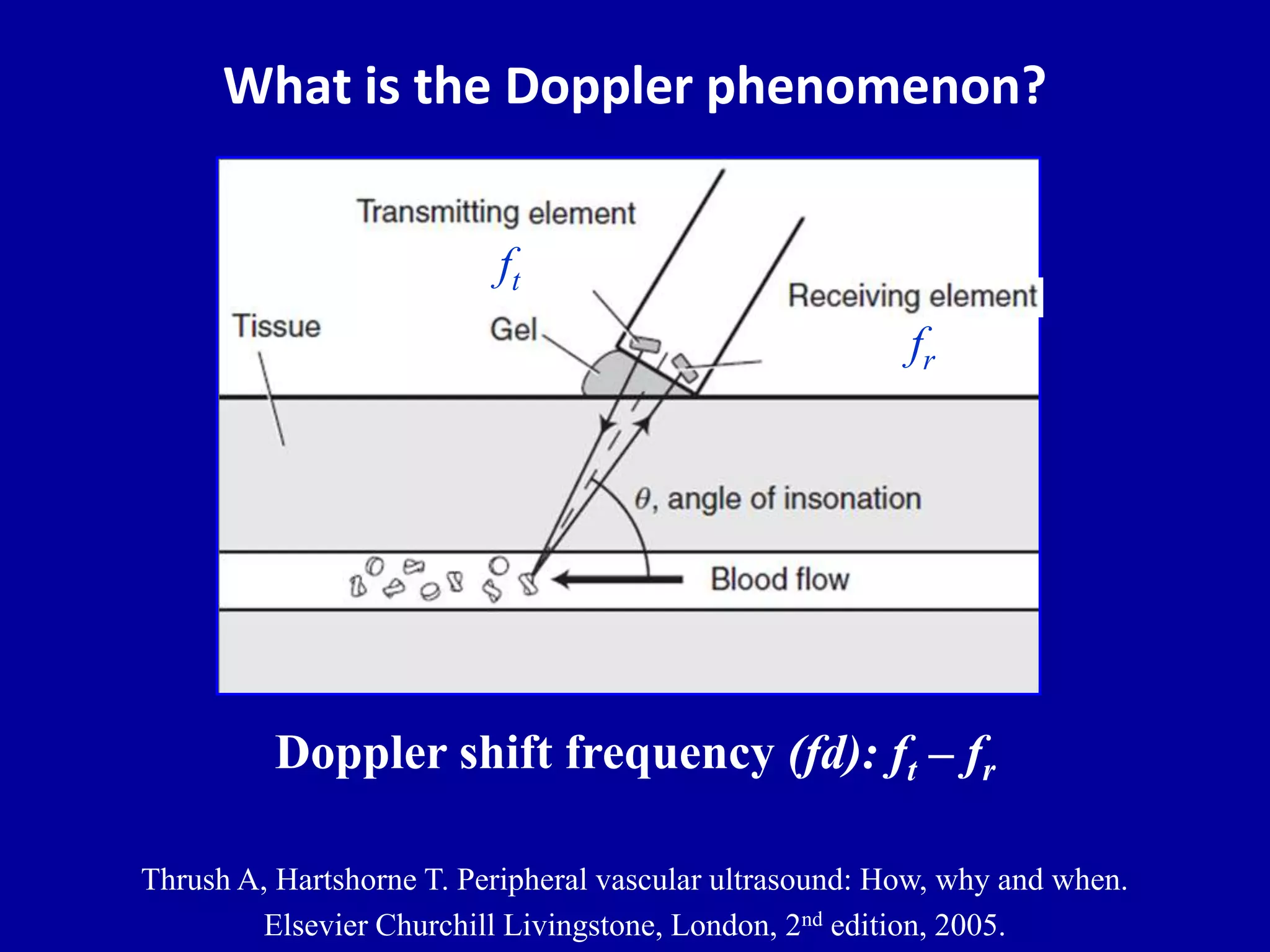 Doppler ultrasound of the portal system - Normal findings | PPTX