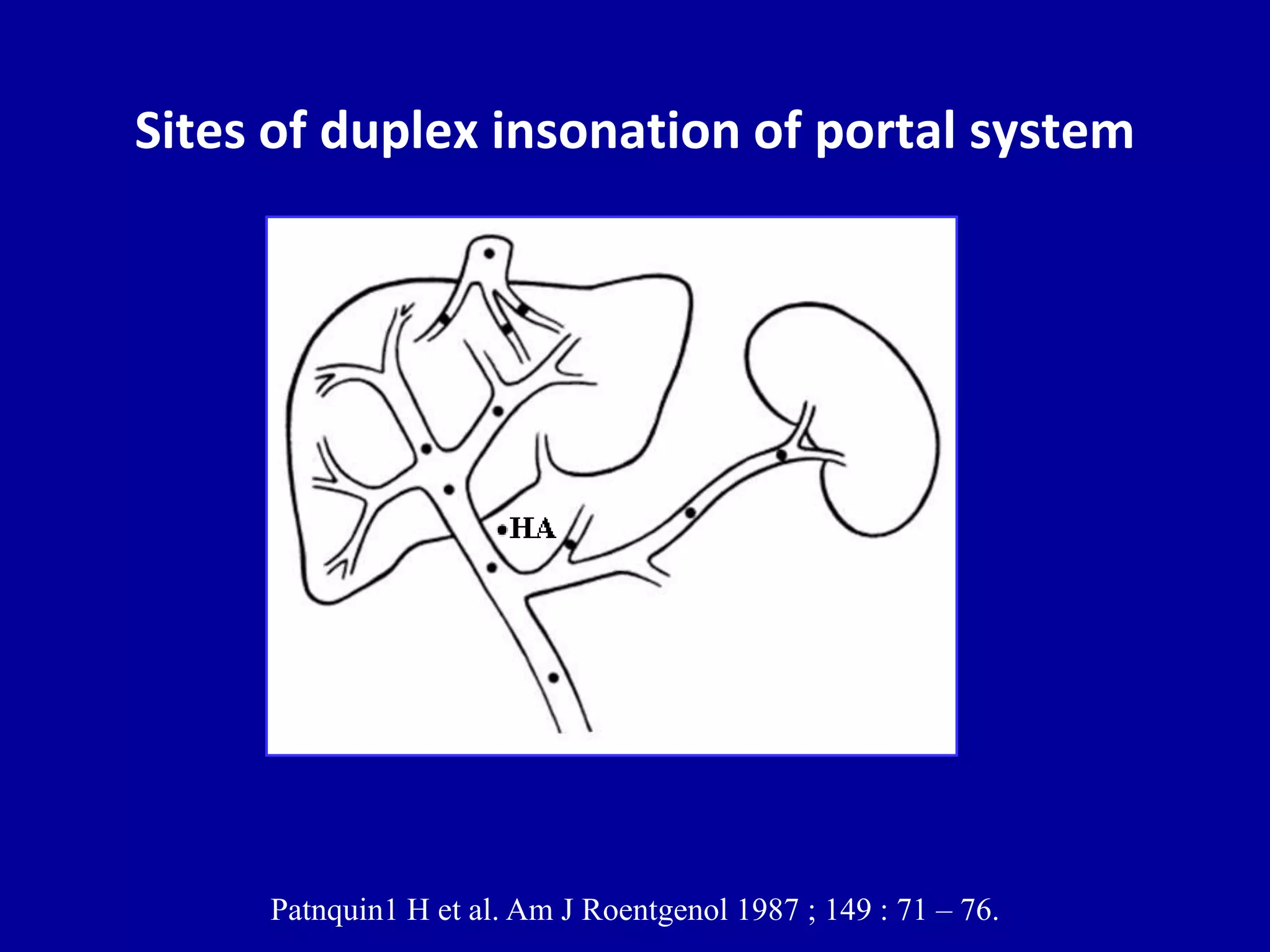 Doppler ultrasound of the portal system - Normal findings | PPTX