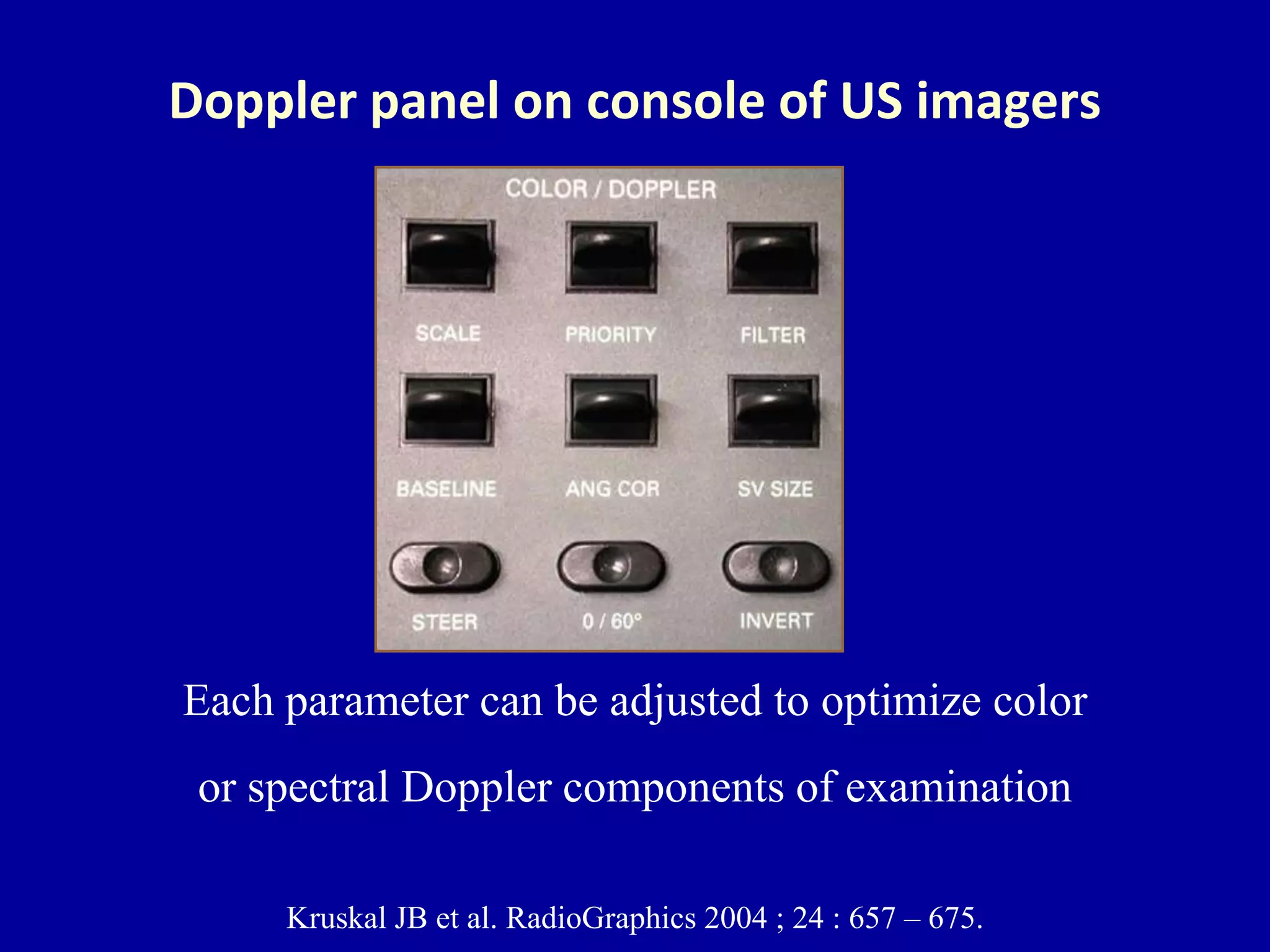 Doppler ultrasound of the portal system - Normal findings | PPTX