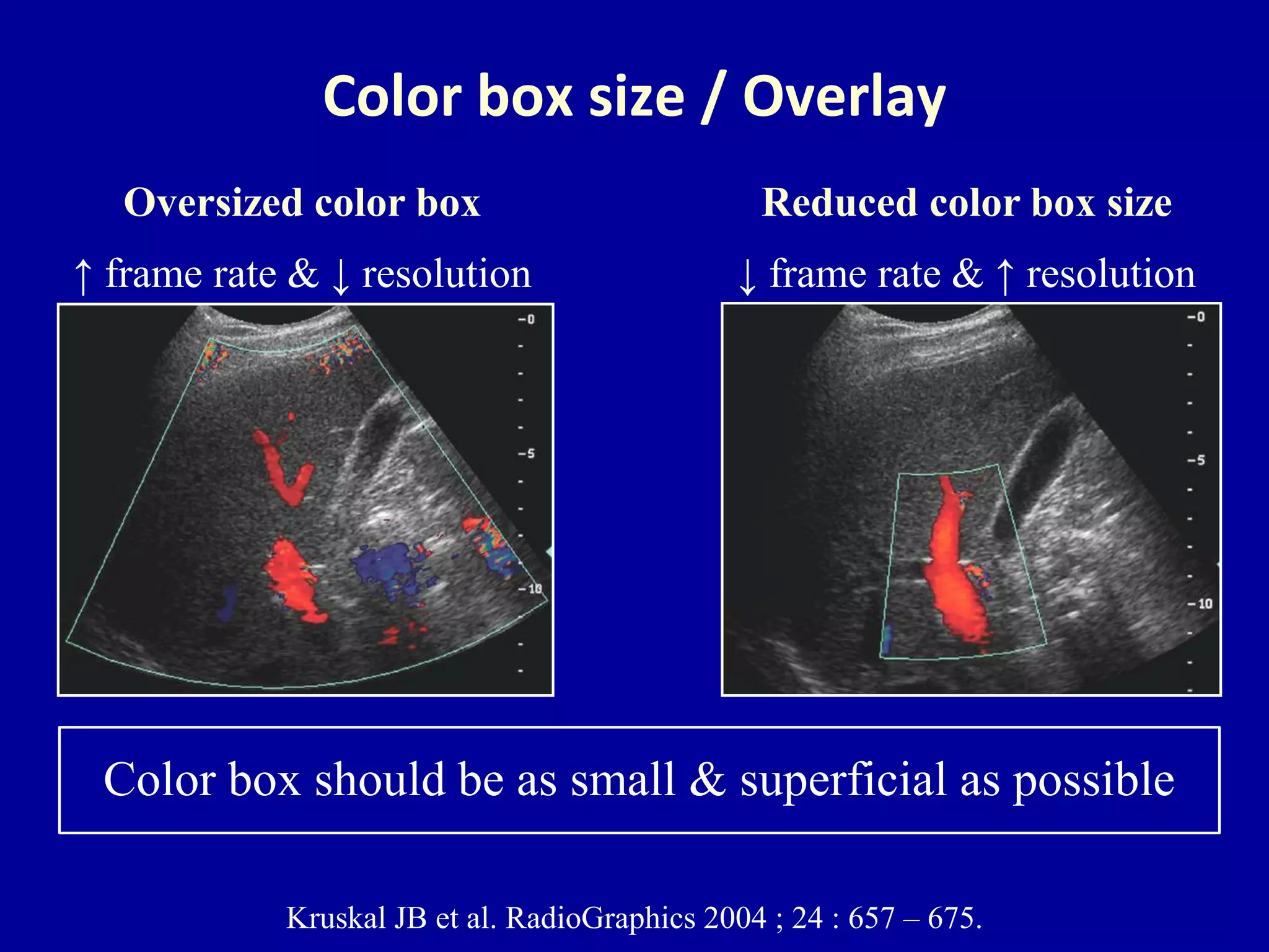 Doppler ultrasound of the portal system - Normal findings | PPTX