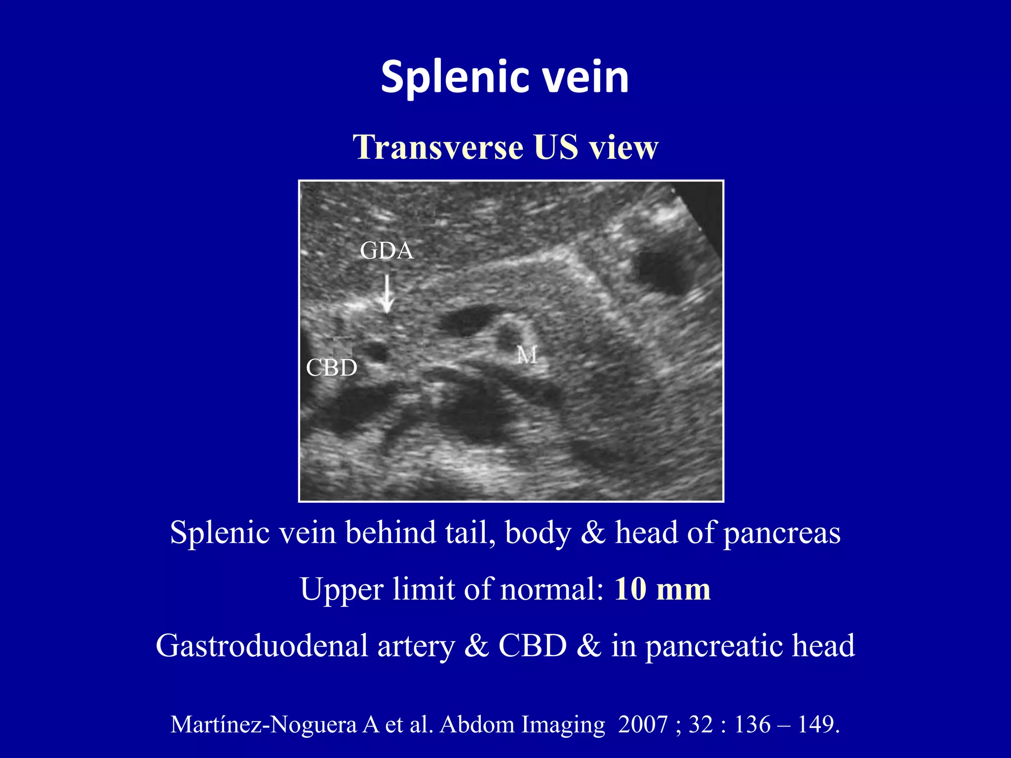 Doppler ultrasound of the portal system - Normal findings | PPTX