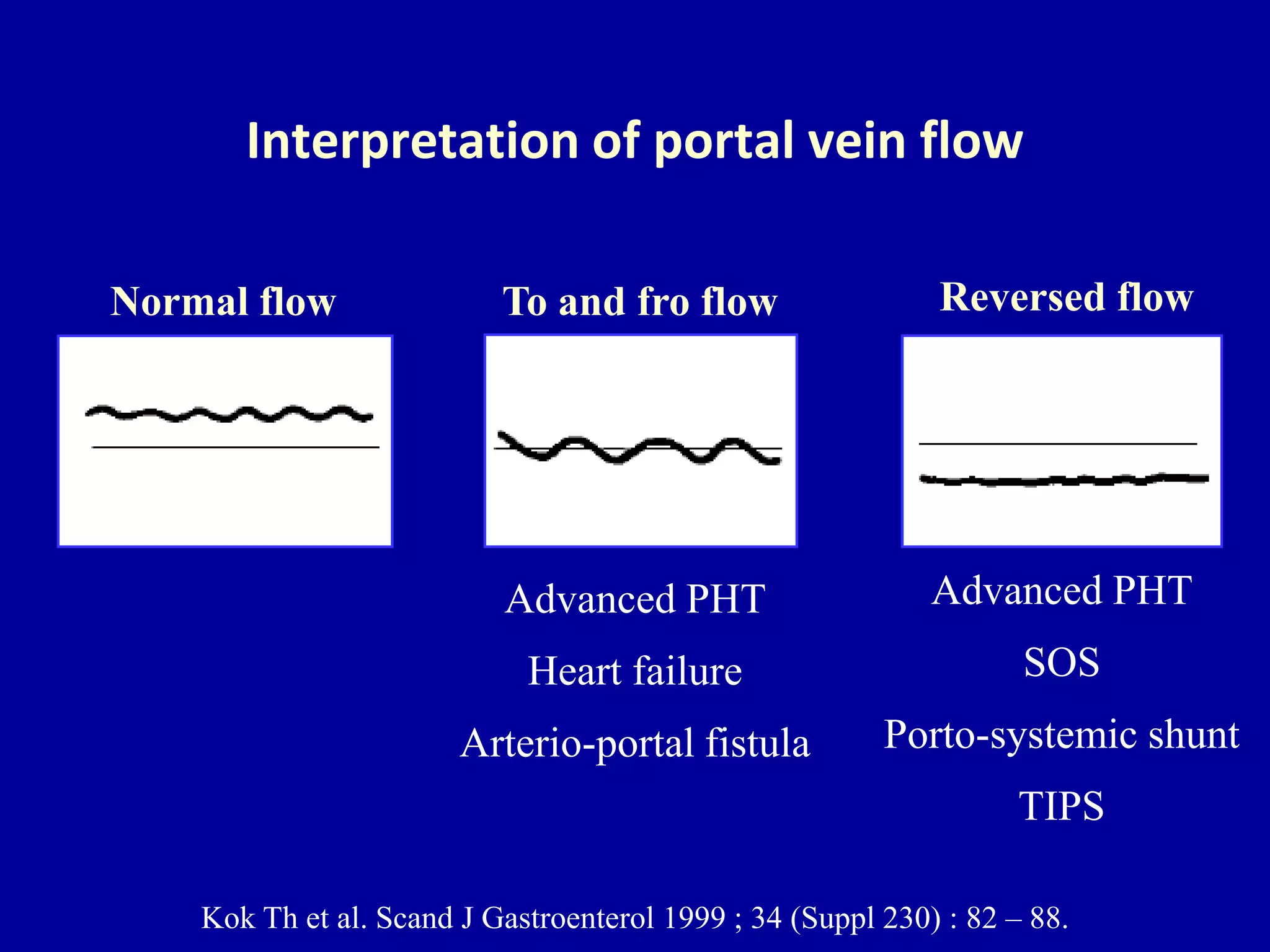 Doppler ultrasound of the portal system - Normal findings | PPTX