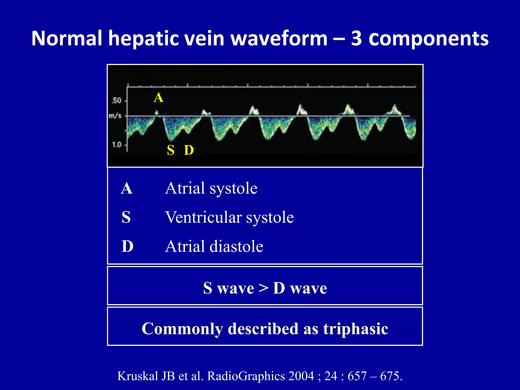 Doppler ultrasound of the portal system - Normal findings | PPTX