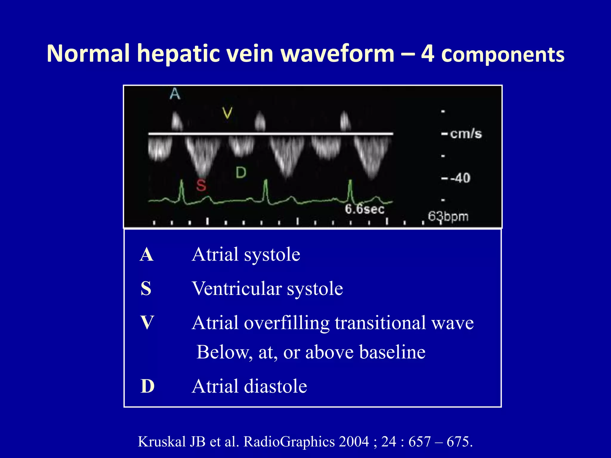 Doppler ultrasound of the portal system - Normal findings | PPTX