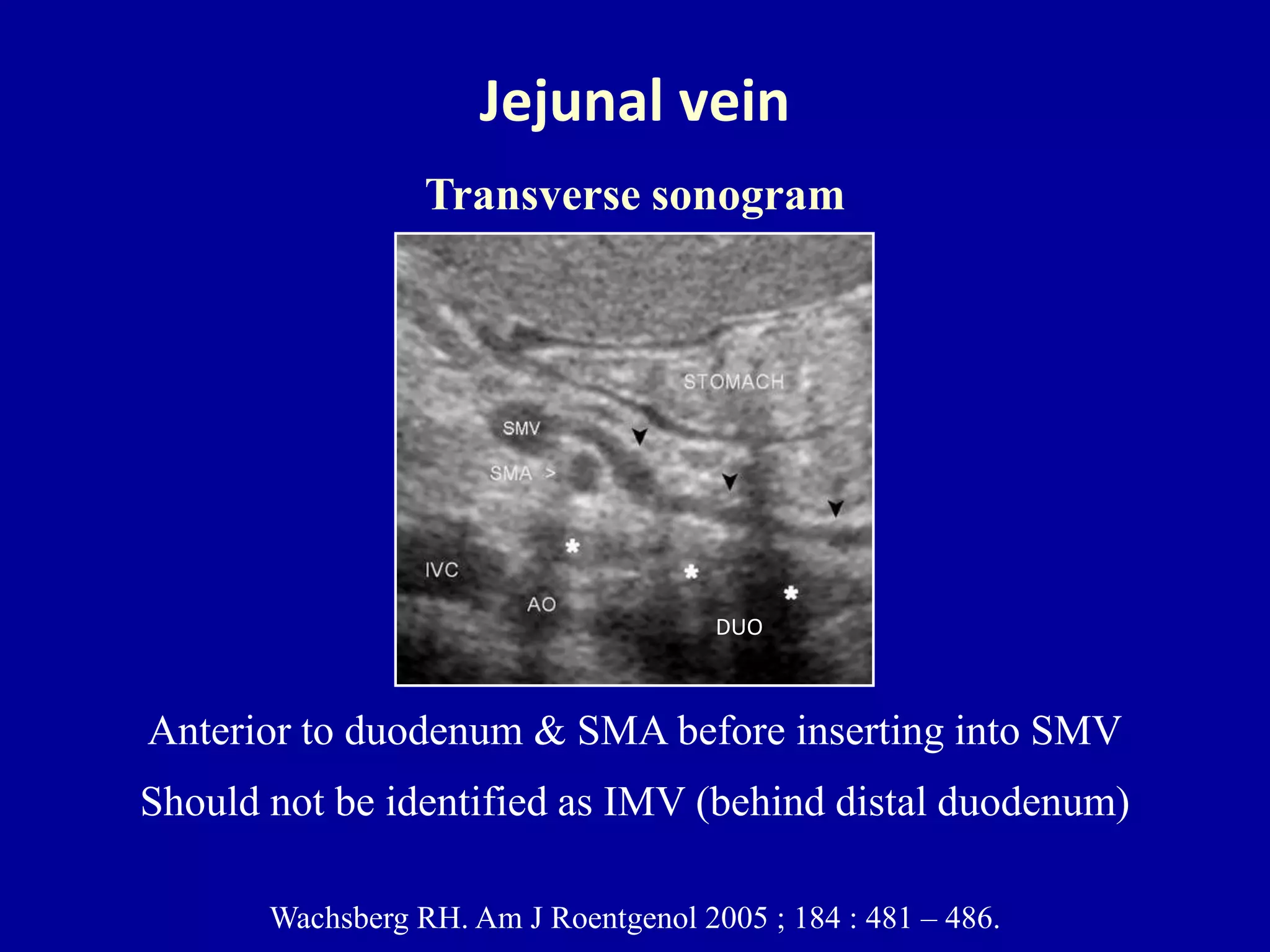 Doppler ultrasound of the portal system - Normal findings | PPTX