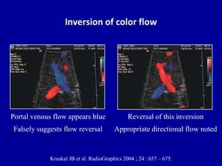 Doppler ultrasound of the portal system - Normal findings | PPTX