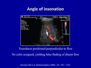 Doppler ultrasound of the portal system - Normal findings | PPTX