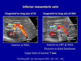 Superior Mesenteric Vein Ultrasound