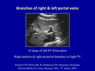 Right Portal Vein Ultrasound