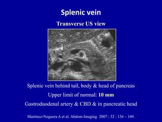 Splenic Vein Ultrasound