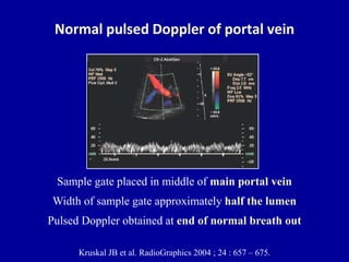 Normal Portal Vein Ultrasound