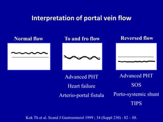 Normal Portal Vein Ultrasound