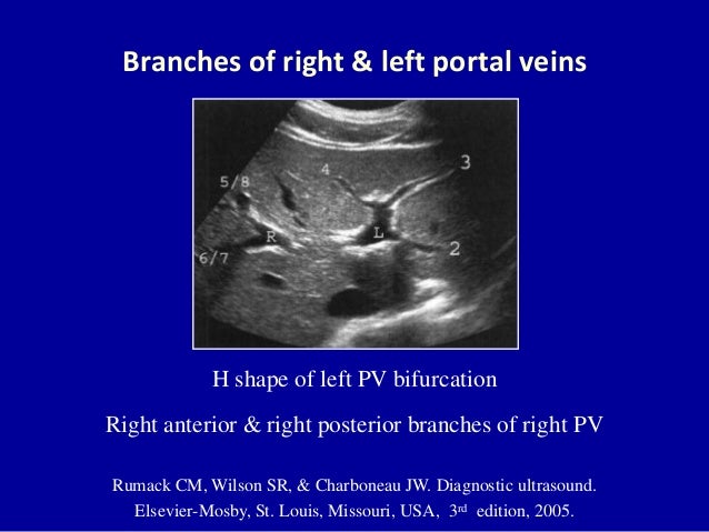 Doppler ultrasound of the portal system - Normal findings