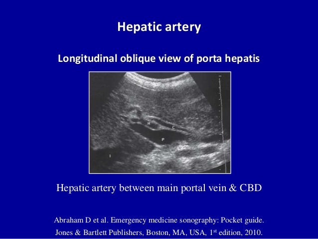 Hepatic Artery Ultrasound