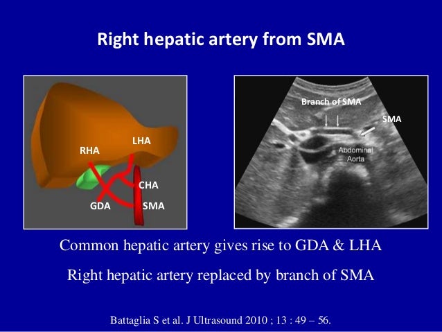 Hepatic Artery Ultrasound