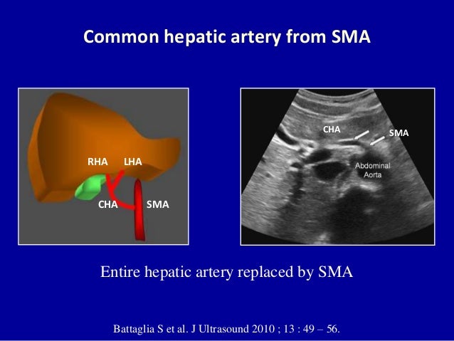 Common Hepatic Artery Ultrasound