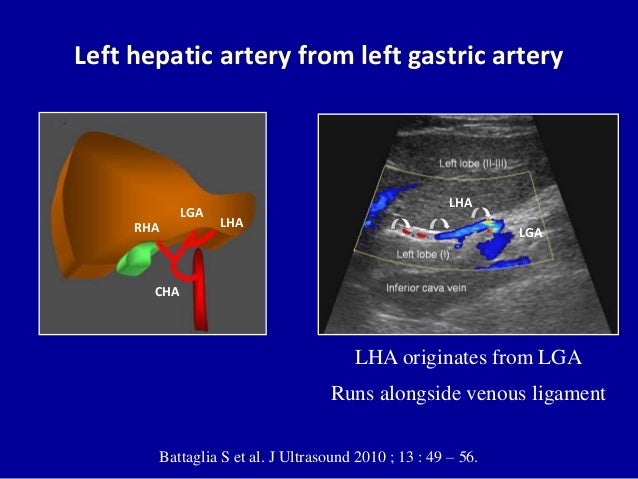 Hepatic Artery Ultrasound