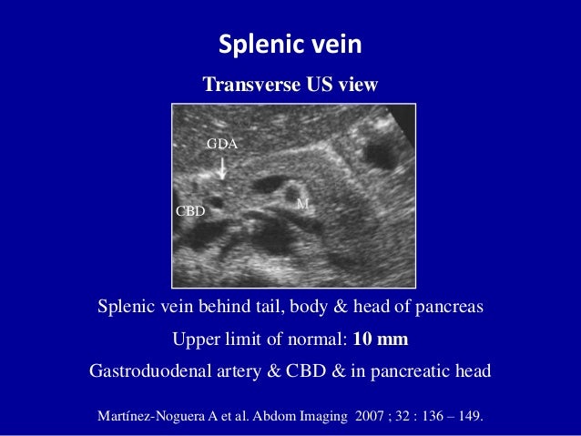 Doppler ultrasound of the portal system - Normal findings