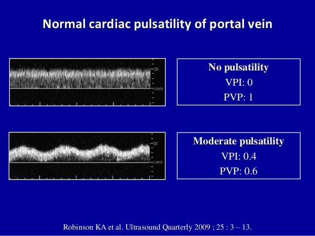 Doppler ultrasound of the portal system - Normal findings