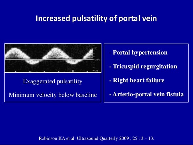 Doppler ultrasound of the portal system - Normal findings