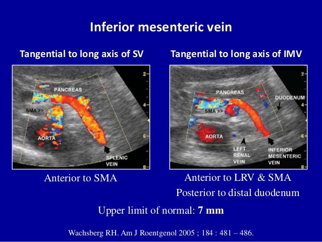 Doppler ultrasound of the portal system - Normal findings