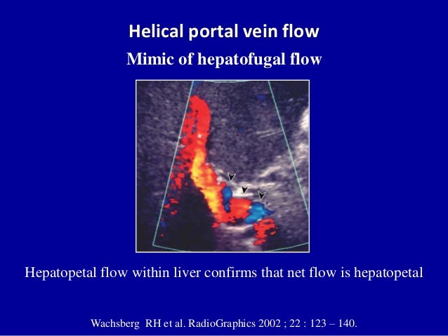 Doppler ultrasound of the portal system - Normal findings