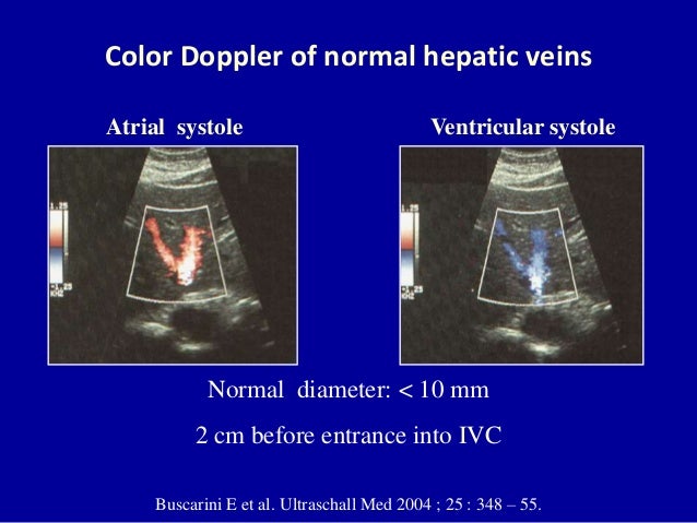 Doppler ultrasound of the portal system - Normal findings
