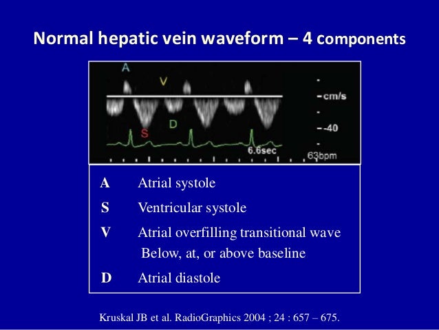 Doppler ultrasound of the portal system - Normal findings