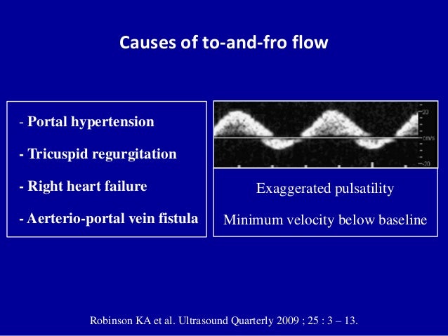 Doppler ultrasound of the portal system - Pathological findings