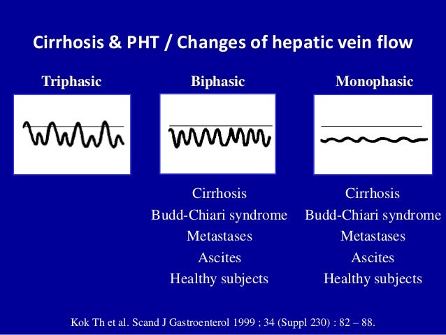 Doppler ultrasound of the portal system - Pathological findings