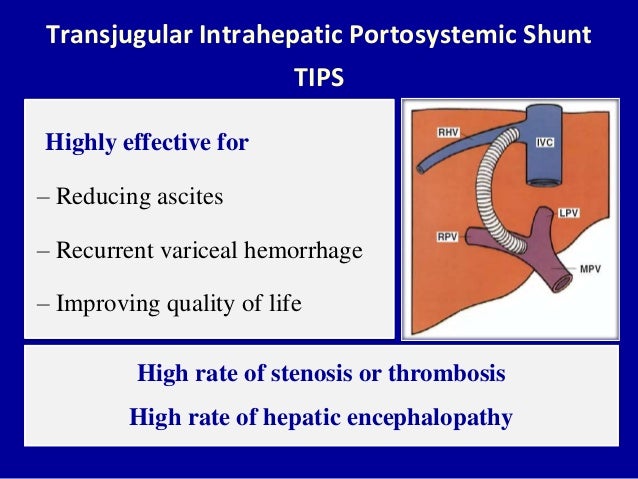 Doppler ultrasound of the portal system - Pathological findings