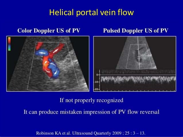 Doppler of the portal system