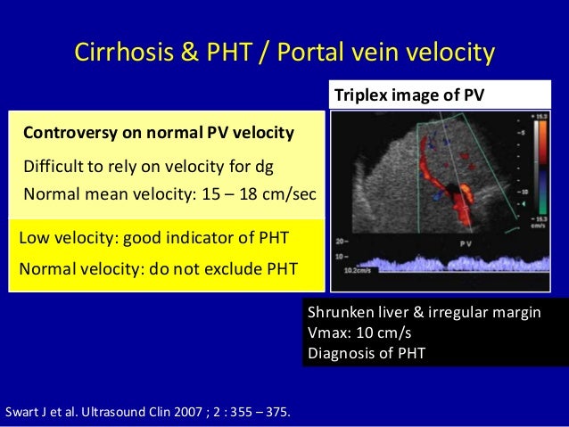Doppler of the portal system pathologies