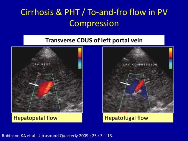 Doppler of the portal system pathologies
