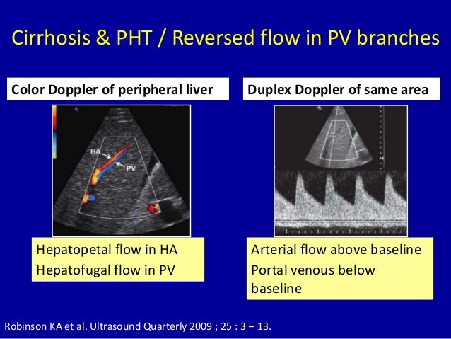 Doppler of the portal system pathologies
