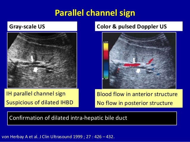 Doppler of the portal system pathologies