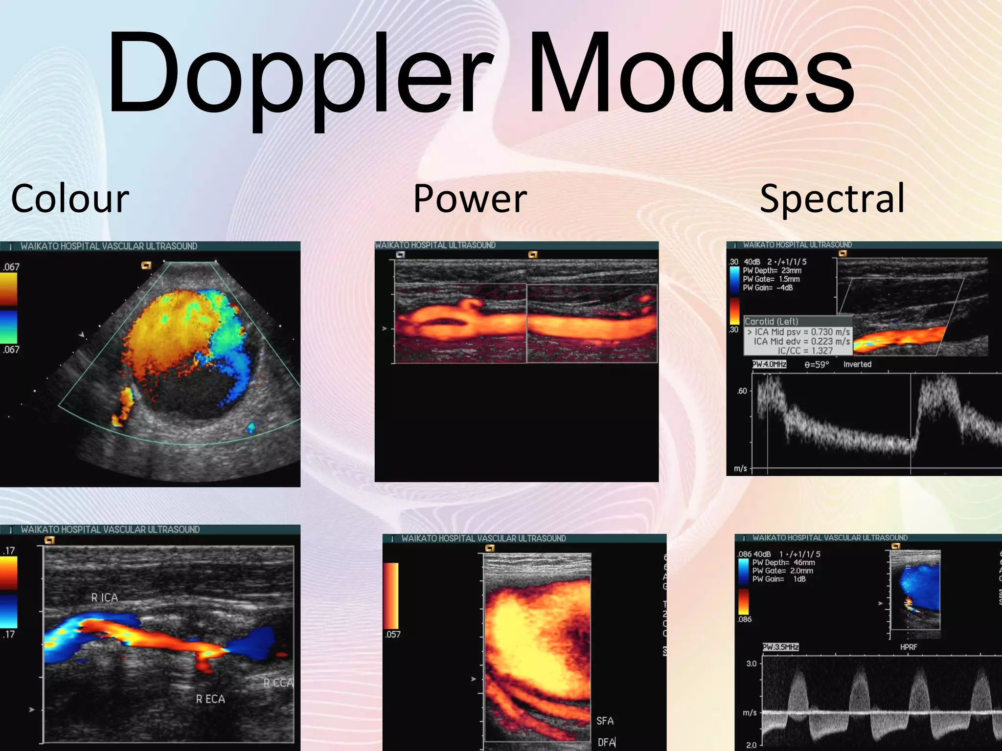 Doppler Physics | PDF