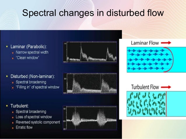 Doppler Physics